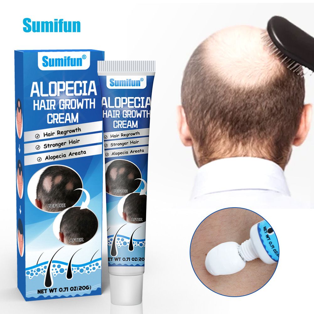 Sumifun Alopecia Hair Growth Cream | Sumifun Official
