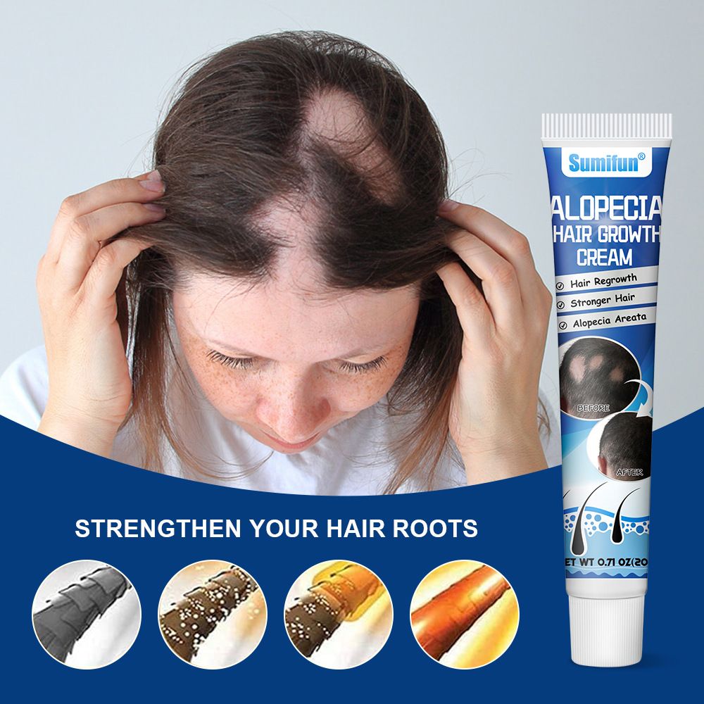 Sumifun Alopecia Hair Growth Cream | Sumifun Official